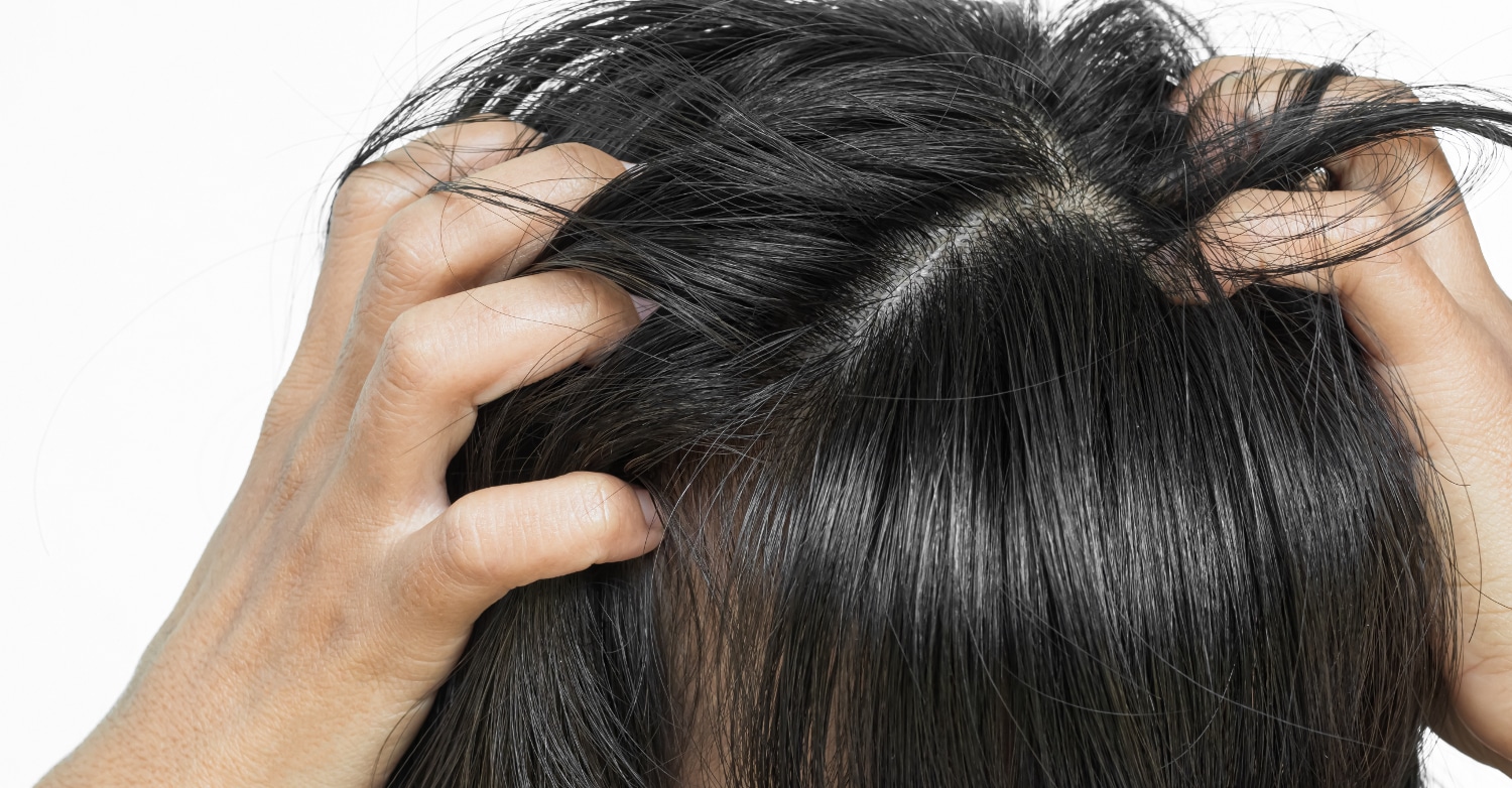 5 Powerful Remedies for Itchy Scalp and Hair Loss - Vitamins Revive