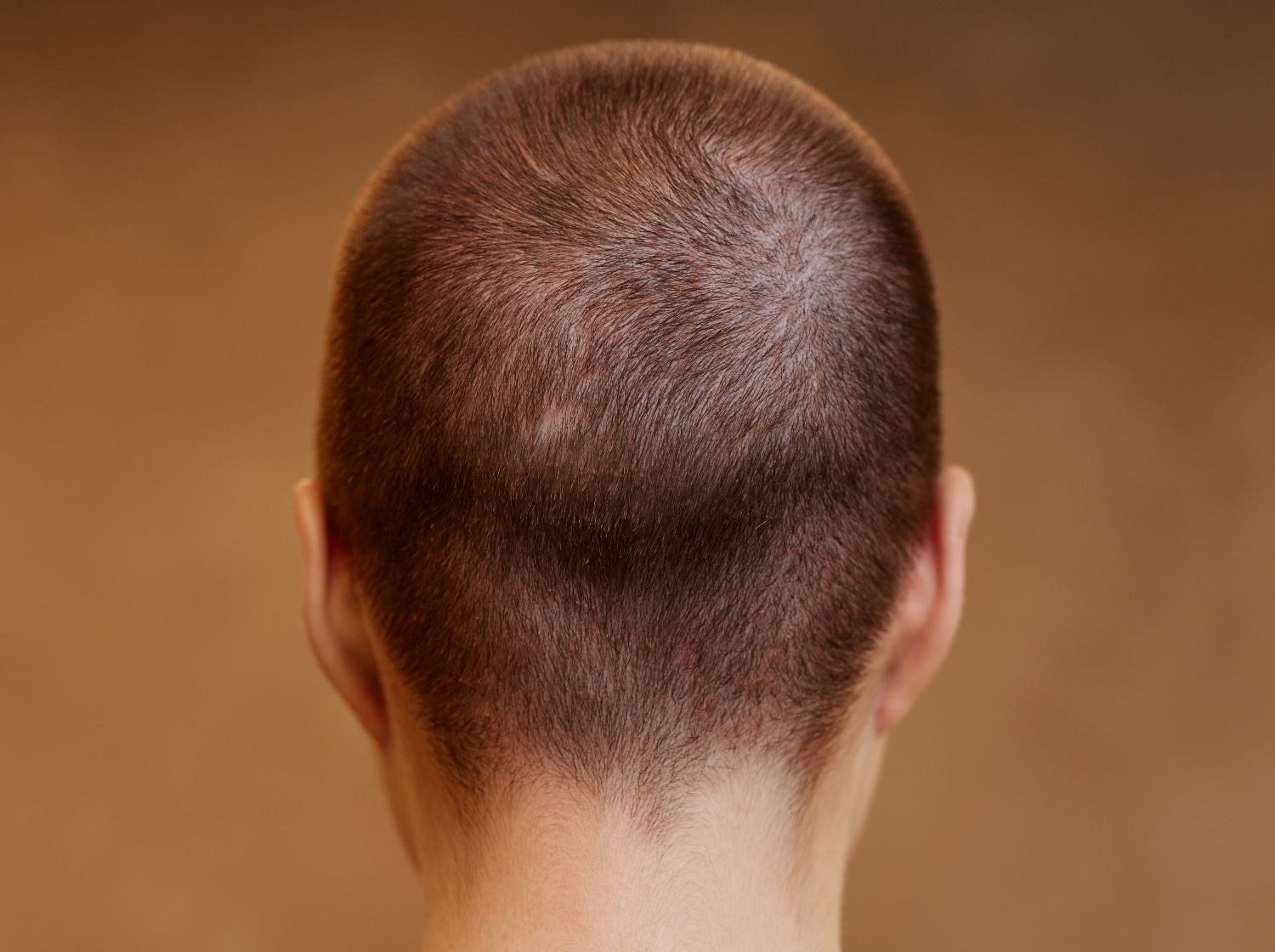 Powerful Remedies for Hair Thinning at Back of Head Female